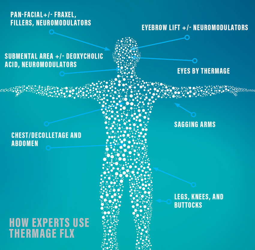 Thermage FLX: A New Advancement for Tissue Tightening