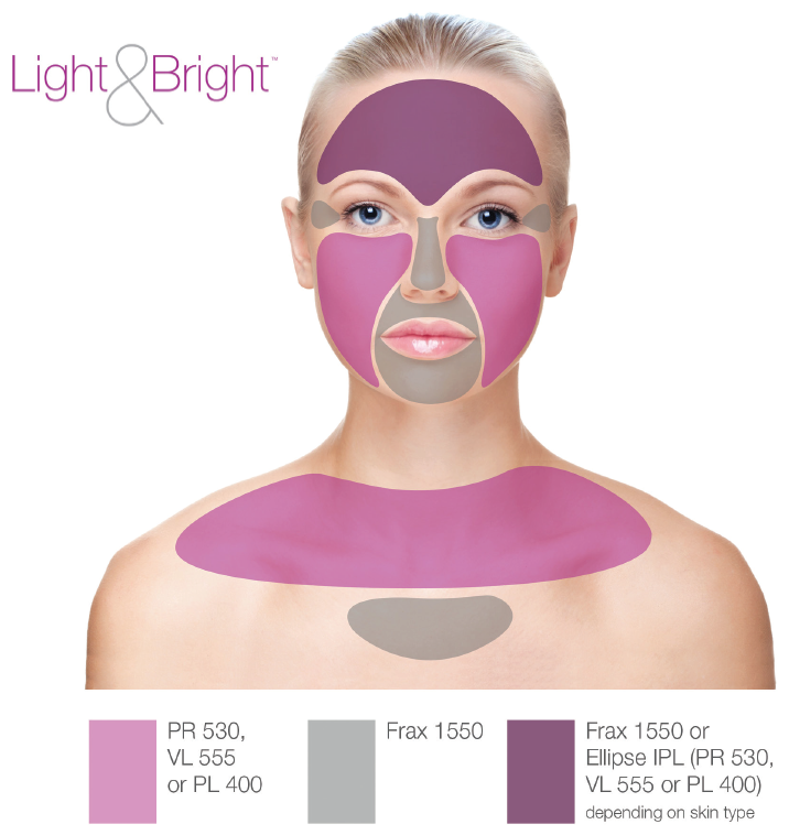 Light & Bright™ Treatment