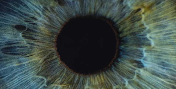Permanent Iris Color Change