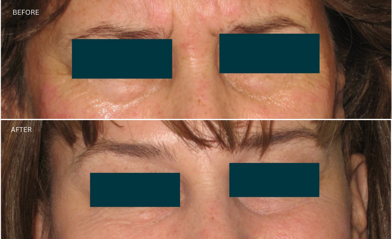 Growth Factors as a Cornerstone in Cost-Effective Regenerative Medicine ...